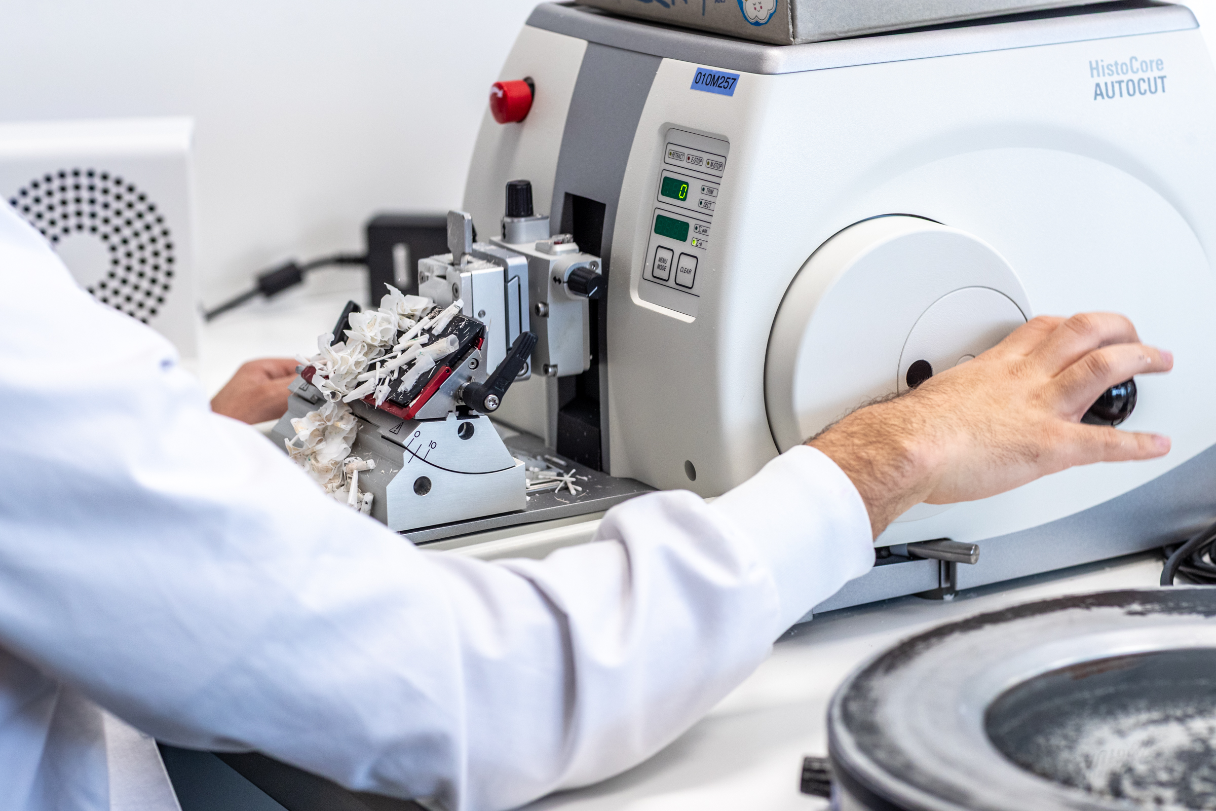 Anatomopathologie | Institut de Pathologie et Génétique